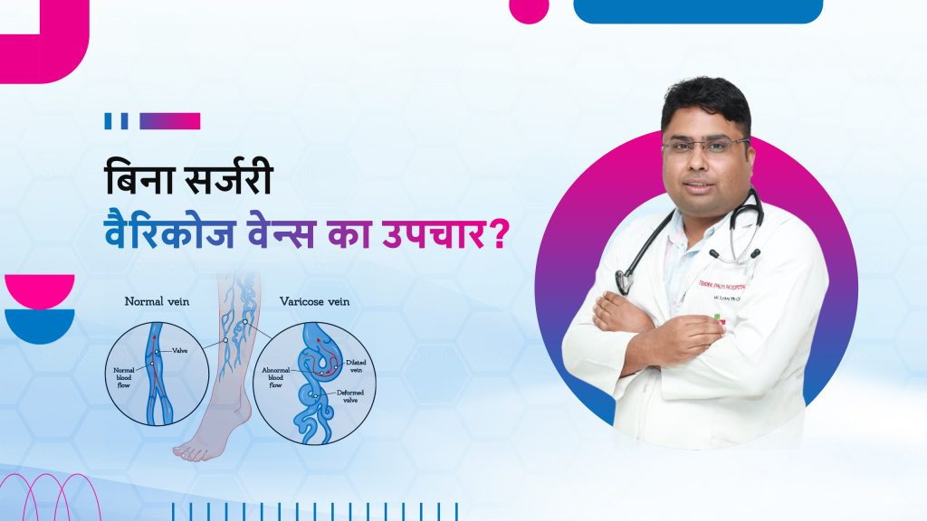 Advanced Non-Surgical Varicose Vein Treatments | Expert Guide